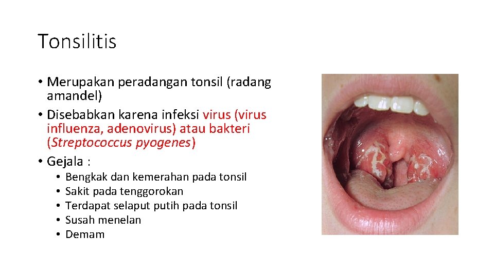 Penyakitpenyakit yang Disebabkan oleh Mikroba Patogen Kemampuan Akhir