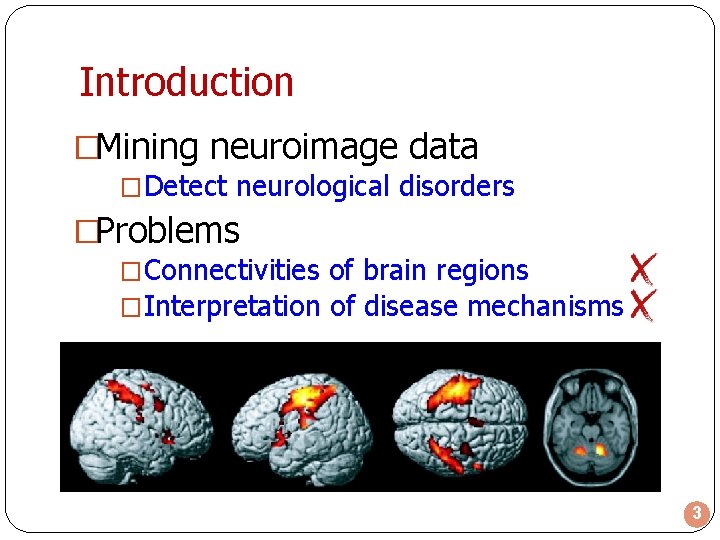 Identifying Connectivity Patterns for Brain Diseases via Multisideview