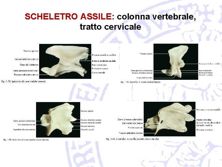 SCHELETRO ASSILE colonna vertebrale SCHELETRO ASSILE colonna vertebrale