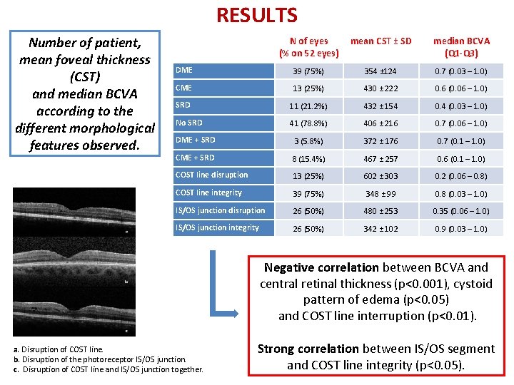 Correlation Between Visual Acuity And Inner Segmentouter Segment 8230