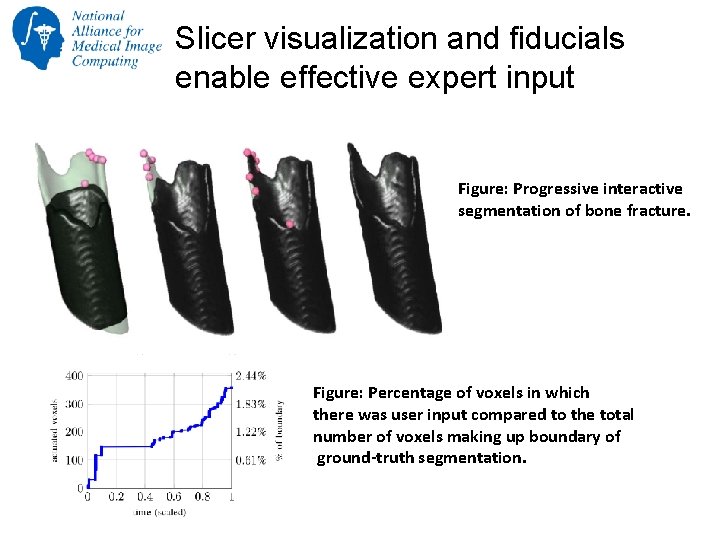 Algorithms UABBU Interactive segmentation feedback model Slicer visualization