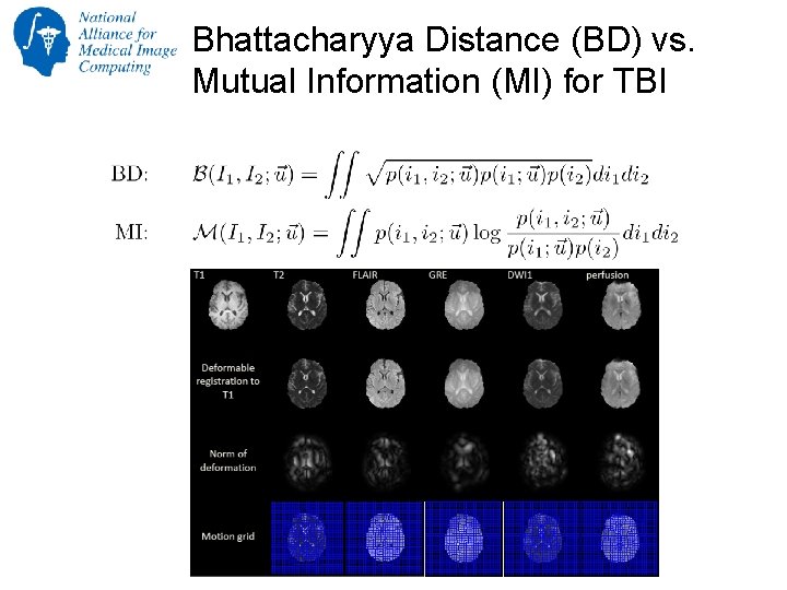 Algorithms UABBU Interactive segmentation feedback model Slicer visualization