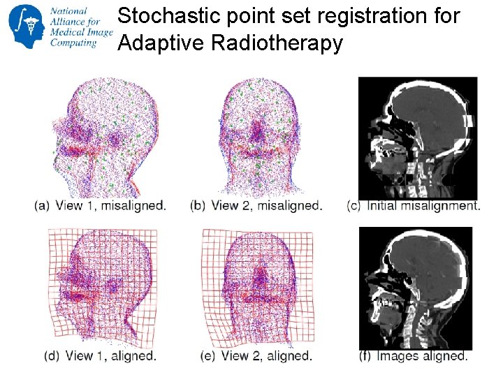 Algorithms UABBU Interactive segmentation feedback model Slicer visualization