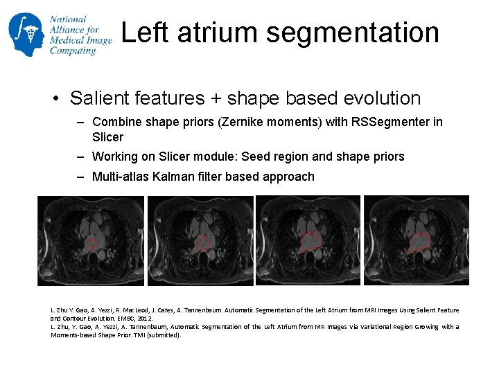 Algorithms UABBU Interactive segmentation feedback model Slicer visualization