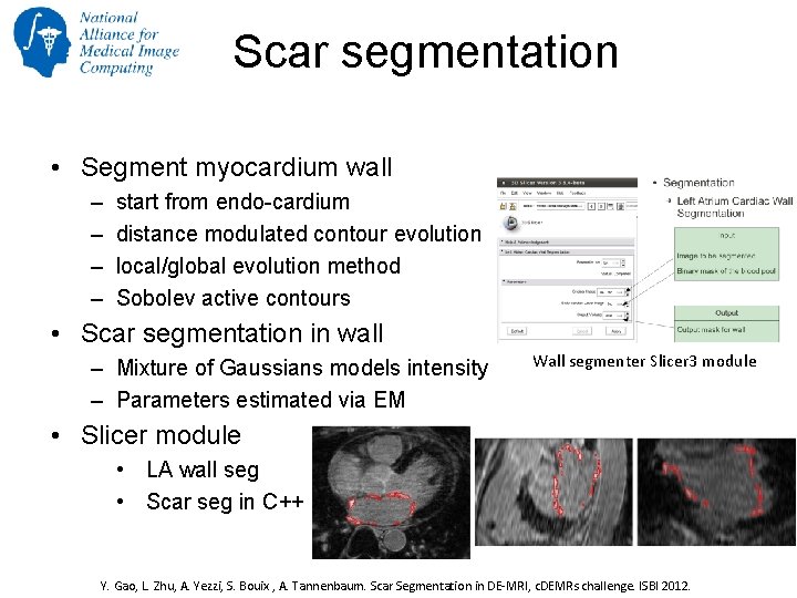 Algorithms UABBU Interactive segmentation feedback model Slicer visualization