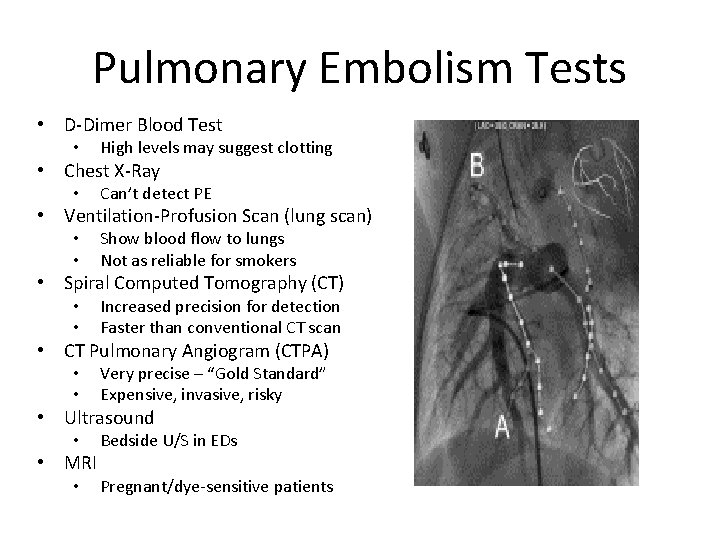 Group 1 Presentation Pulmonary Embolism Introduction to Pulmonary