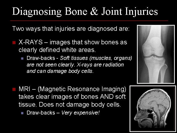 Youre the Radiologist Diagnosing Bone Joint Injuries Your
