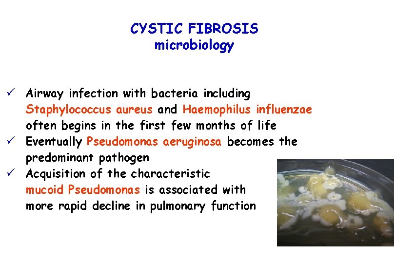 CYSTIC FIBROSIS Is a complex metabolic disorder characterized