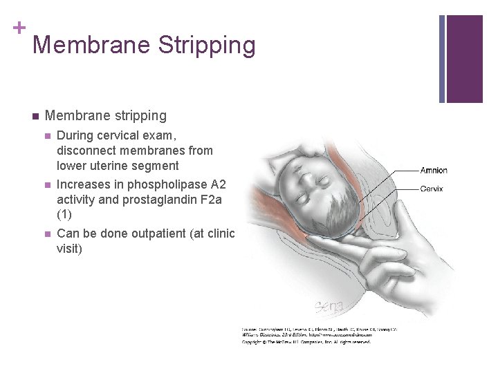 Ways to induce labor Julie Springer Induction n