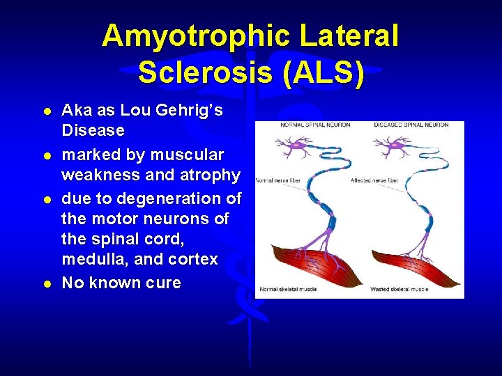Nervous System Disorders and Homeostatic Imbalances Alzheimers Disease