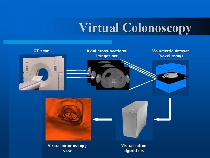 Automatic Virtual Colonoscopy Based Diagnostic Decision Support System