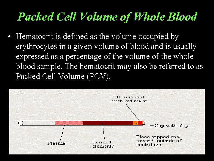 Packed Cell Volume of Whole Blood Hematocrit is