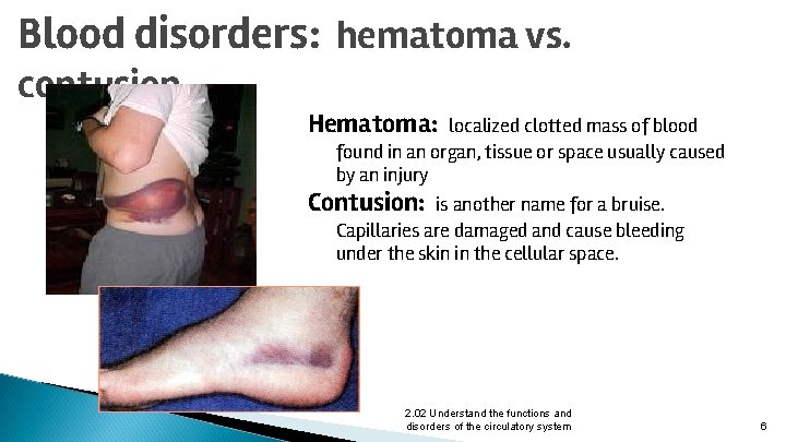 Blood Disorders 2 02 Understand the functions and