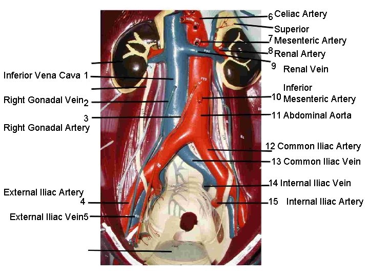 Brachiocephalic Artery 1 Aortic Arch Ascending Aorta 2
