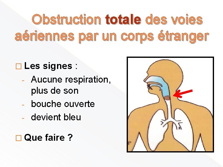 Obstruction des voies ariennes par un corps tranger