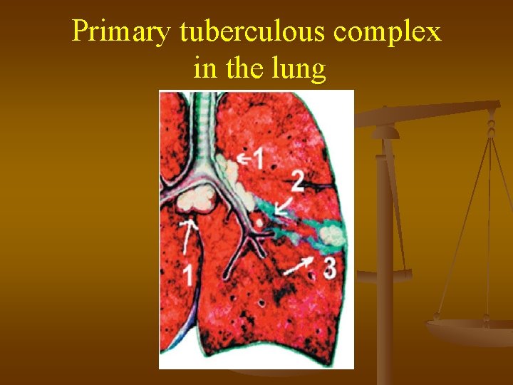 Tuberculosis is infectious contagious disease caused by Mycobacterium