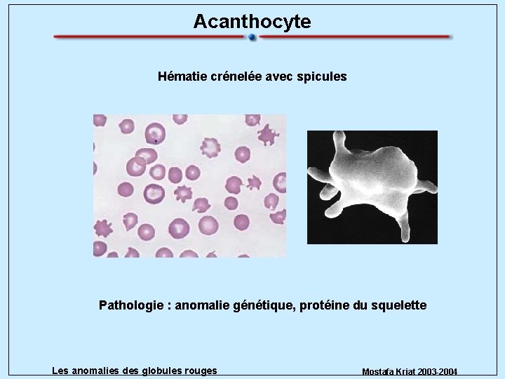 Les anomalies des globules rouges La forme et