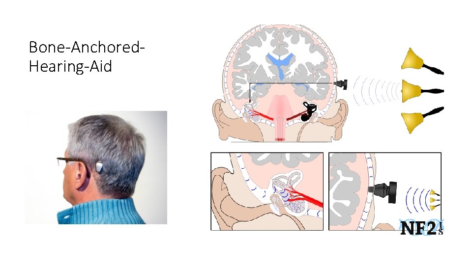 Are You Hearing Your Patients Basic Guide to