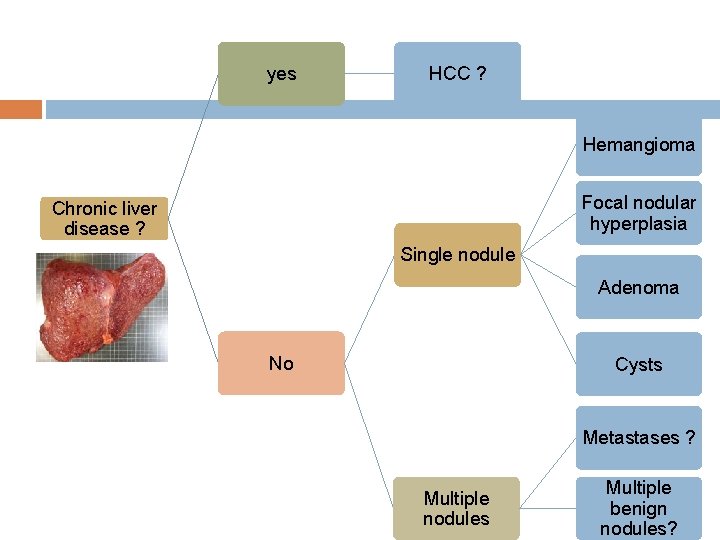 Benign tumors of the liver Tips and Tricks