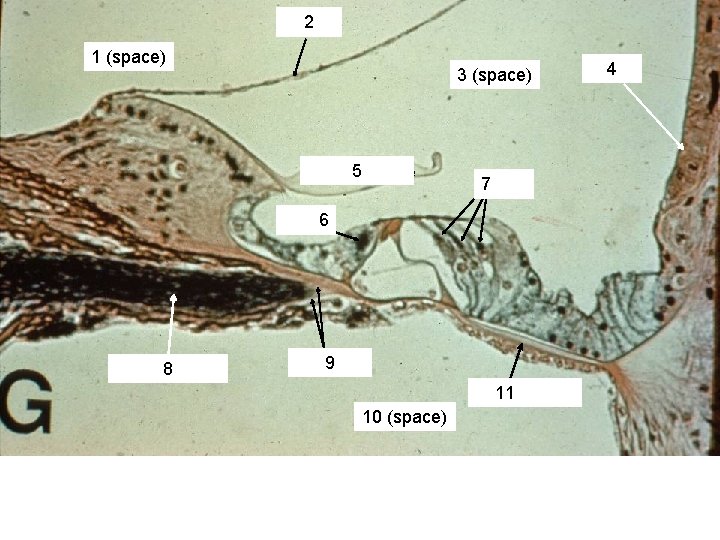 Lab 8 Inner Ear Auditory Pathways Part 7