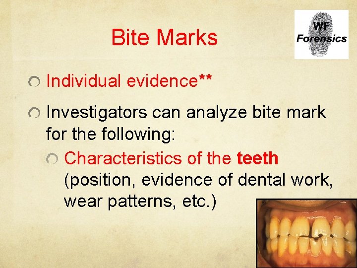 Impressions Objective bite marks Do Now Do you