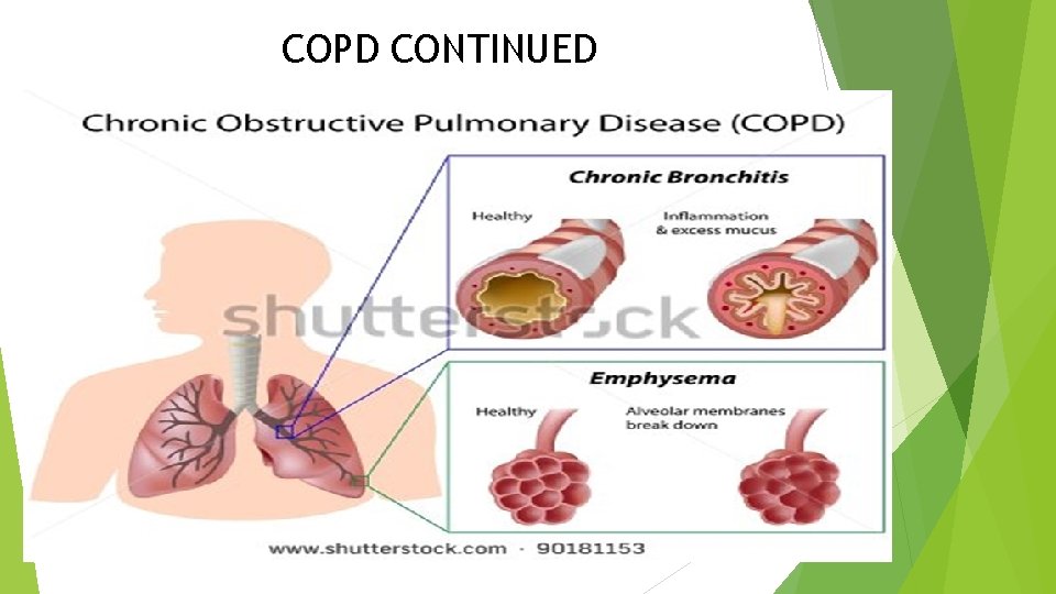 Chapter 12 Tobacco and Alcohol Objectives 1 Identify