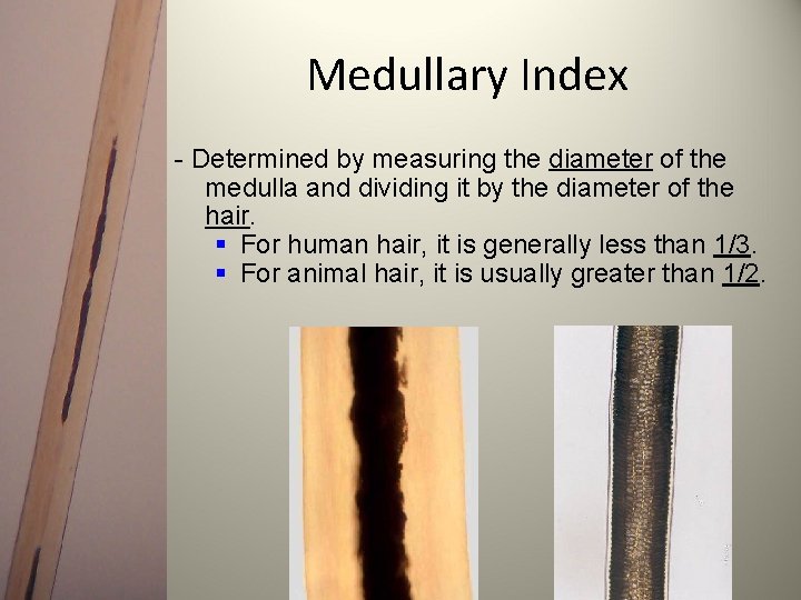 Hair Forensics 352 ODette Famous Case Napoleon Bonaparte