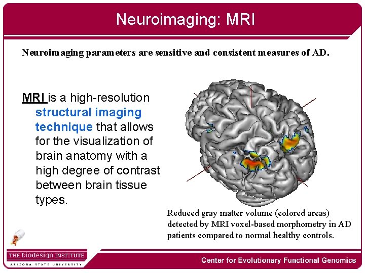 Mining Brain Region Connectivity for Alzheimers Disease Study