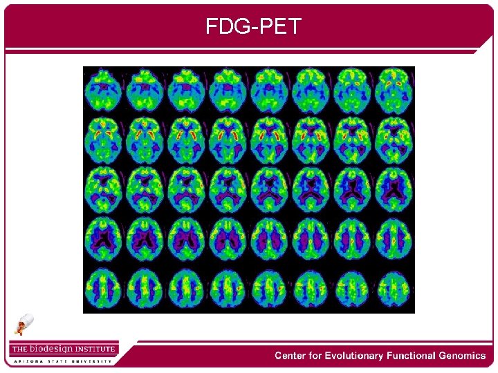 Mining Brain Region Connectivity for Alzheimers Disease Study