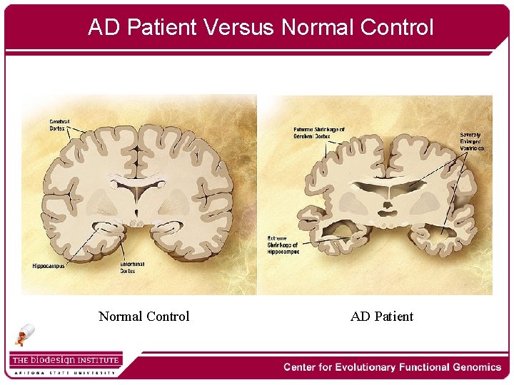 Mining Brain Region Connectivity for Alzheimers Disease Study