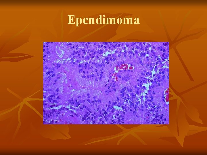 Diferencias entre neoplasias malignas y benignas Comparaciones entre