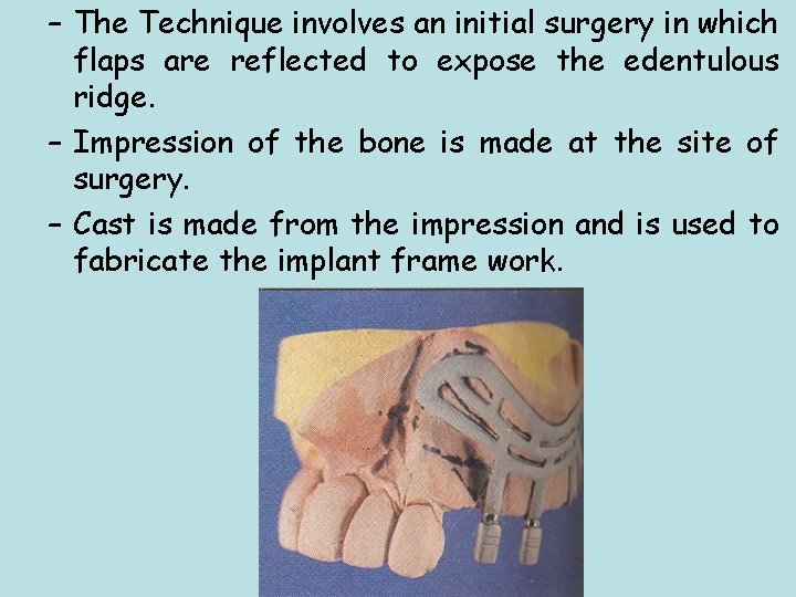 Definition IMPLANTS An implant is a biological or