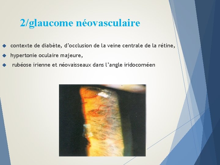 CONDUITE A TENIR DEVANT UNE BAISSE DE LACUITE