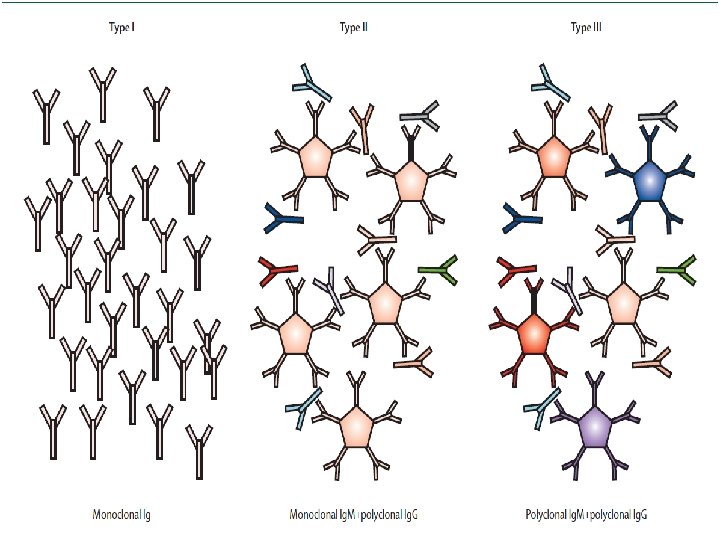 Wintrobe MM Buell MV Hyperproteinemia associated with multiple