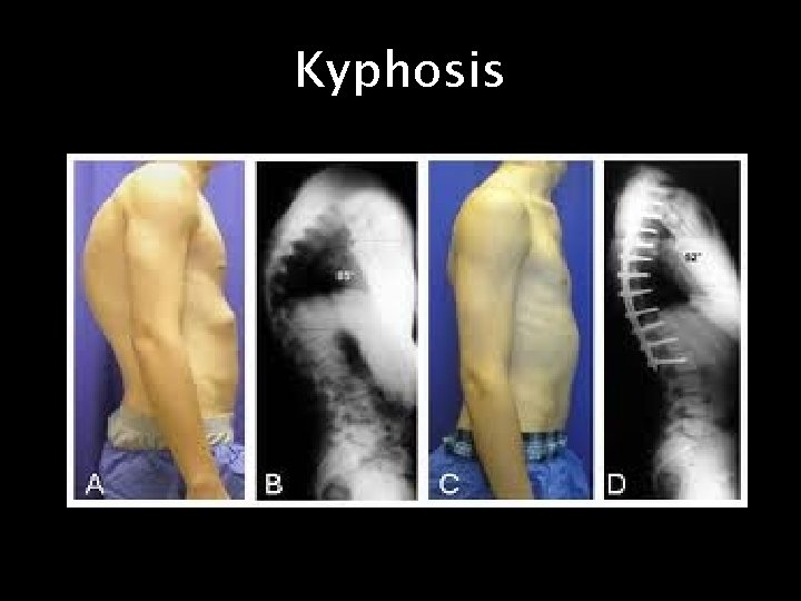 Skeletal System Fun Facts The largest bone is
