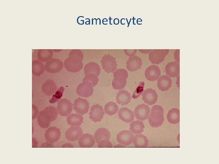 Malaria Case Management Dr Radha Kulkarni MBBS DTMH