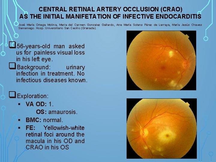 CENTRAL RETINAL ARTERY OCCLUSION CRAO AS THE INITIAL