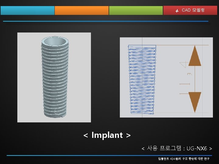 1 Branemark Implant 3 i Implant IMZ Implant