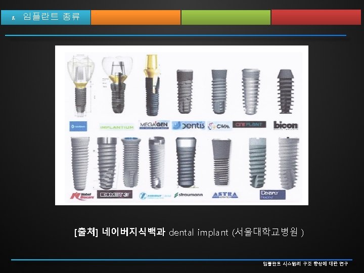 1 Branemark Implant 3 i Implant IMZ Implant