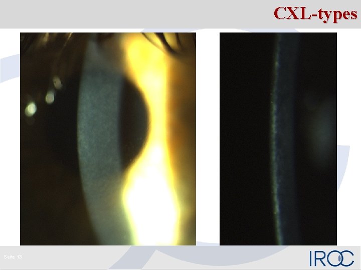 Peripheral optimized CXL and high power Theo Seiler