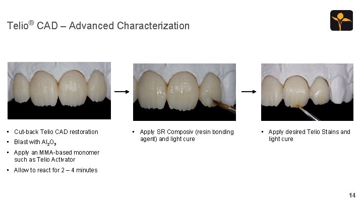 Telio CAD by Nobel Procera Location date Presenter