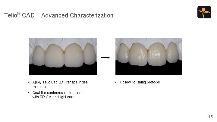 Telio CAD by Nobel Procera Location date Presenter