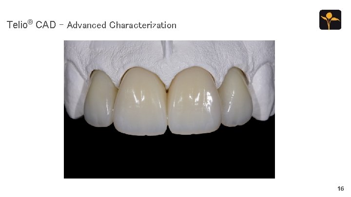 Telio CAD by Nobel Procera Location date Presenter