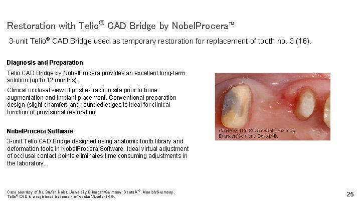 Telio CAD by Nobel Procera Location date Presenter