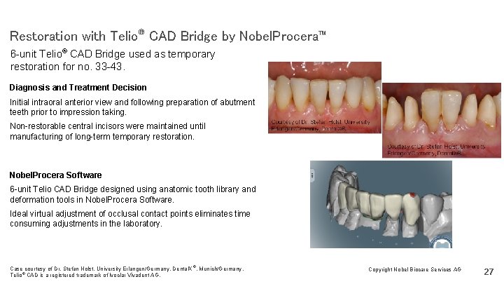 Telio CAD by Nobel Procera Location date Presenter