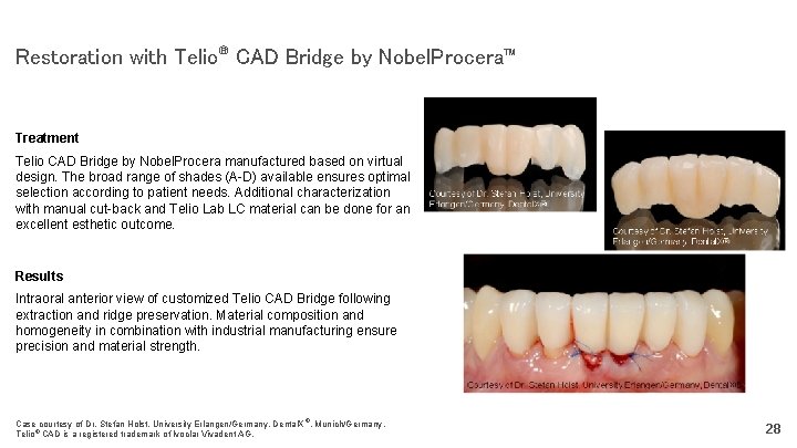 Telio CAD by Nobel Procera Location date Presenter