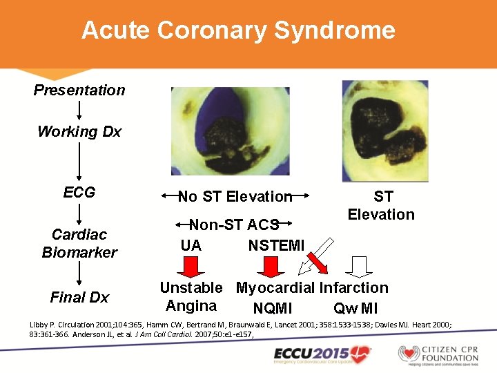 Prehospital NSTEMI Patient Assessment and Treatment Paul A