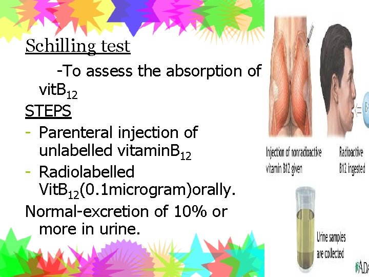 SHORT BOWEL SYNDROME TOM THOMAS MATHEW 2002 BATCH