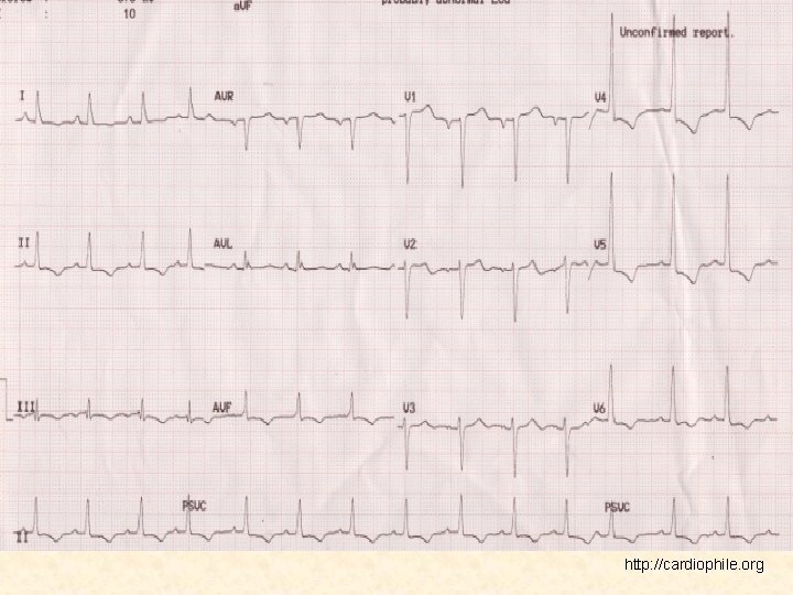 Cardiac Physiology A Casebased Review By Sohin Patel
