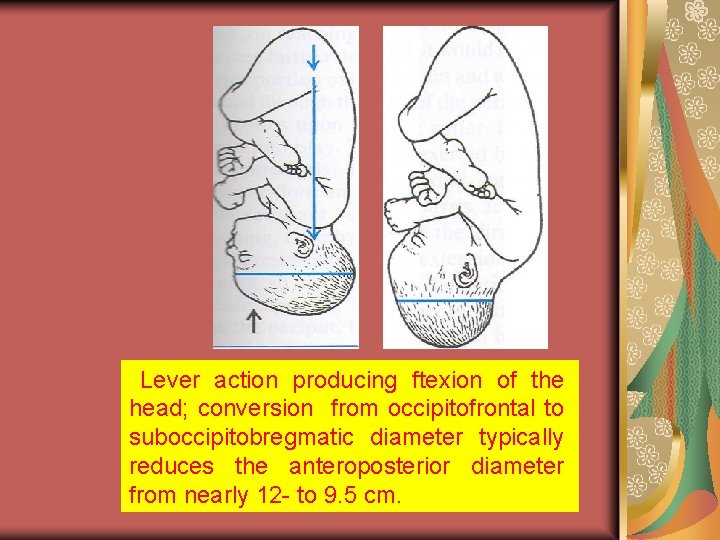 Mechanism of labour Dr wasan Nori MBCHB FICOG